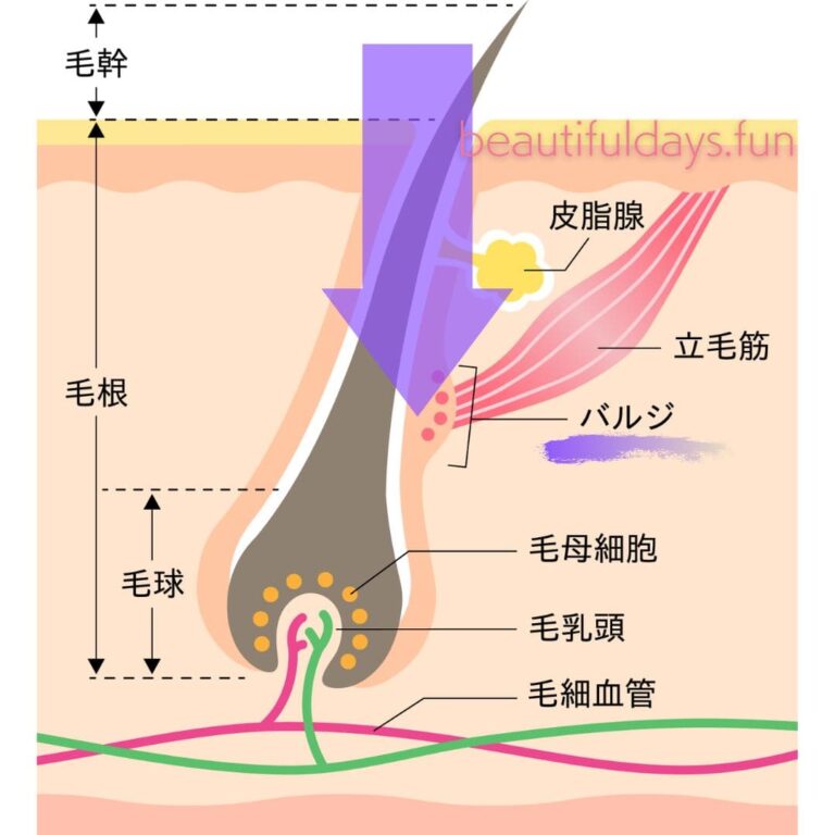 【SBC湘南美容】ミスト脱毛機器アバランチレイズ（アレックス）ってどうなの？VIO脱毛体験 | 私たちのビューティフルデイズ